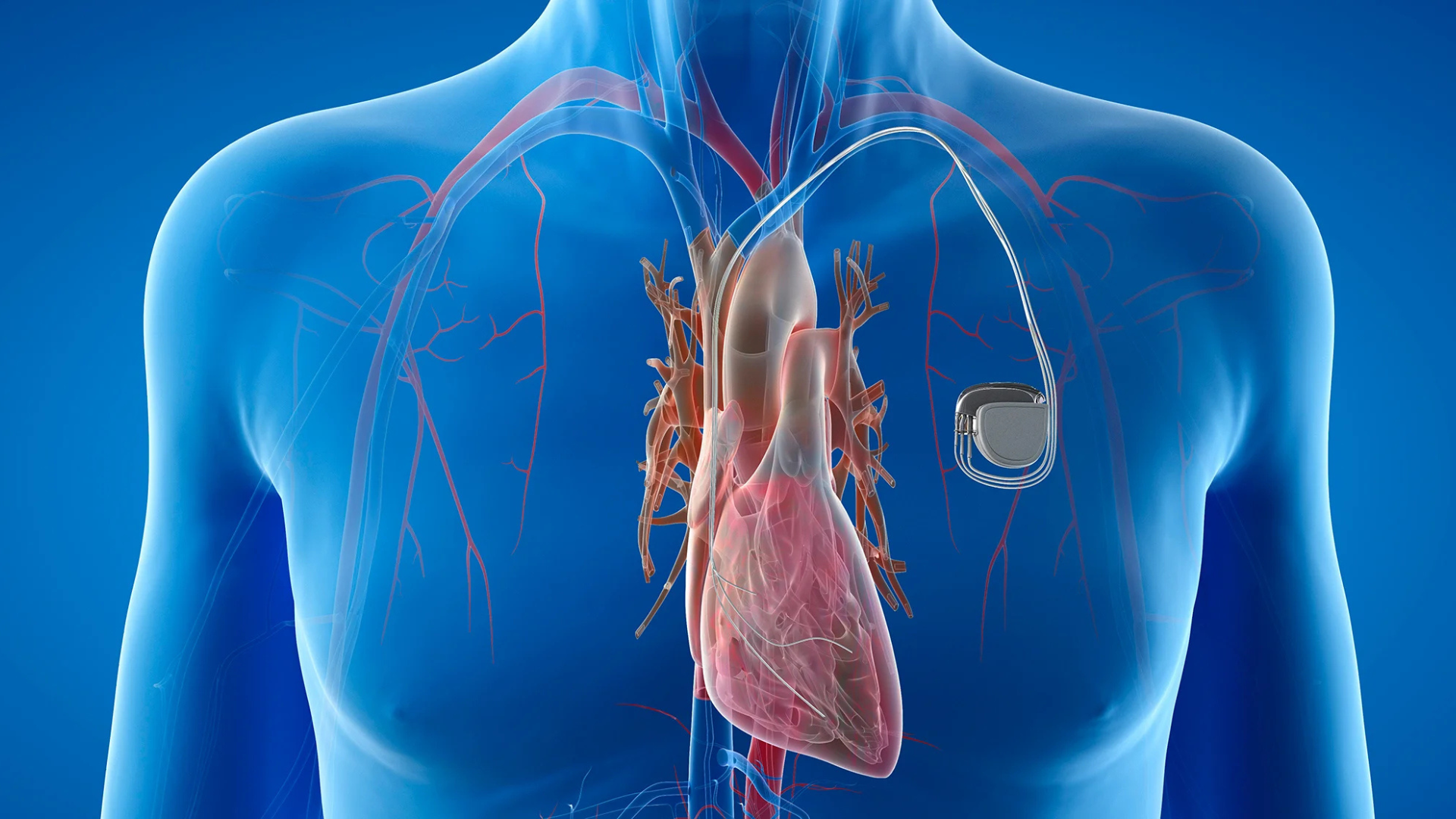 Exploring the Medical Applications of Titanium Alloy Powder